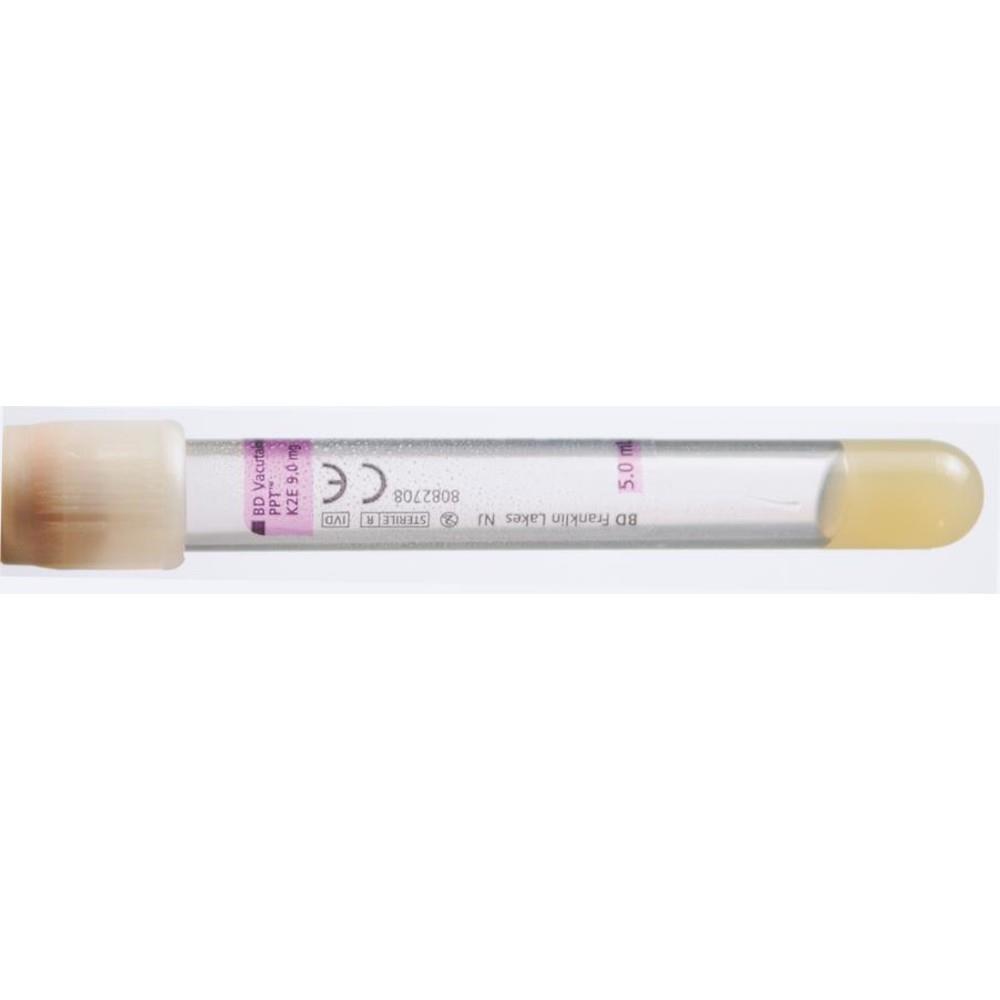 Blood Collection | (SLS) Scientific Laboratory Supplies